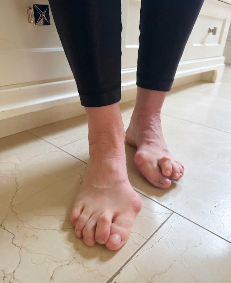 Stylish Shoes for Bunions That Don’t Look Orthopedic